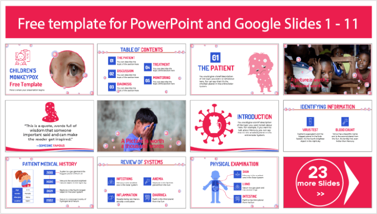 Monkeypox Template for Kids - PowerPoint Templates and Google Slides